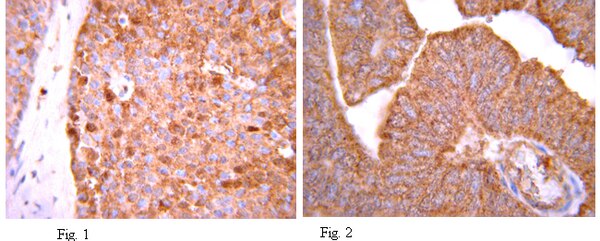 Anti-Bax (NT) Antibody | ABC11